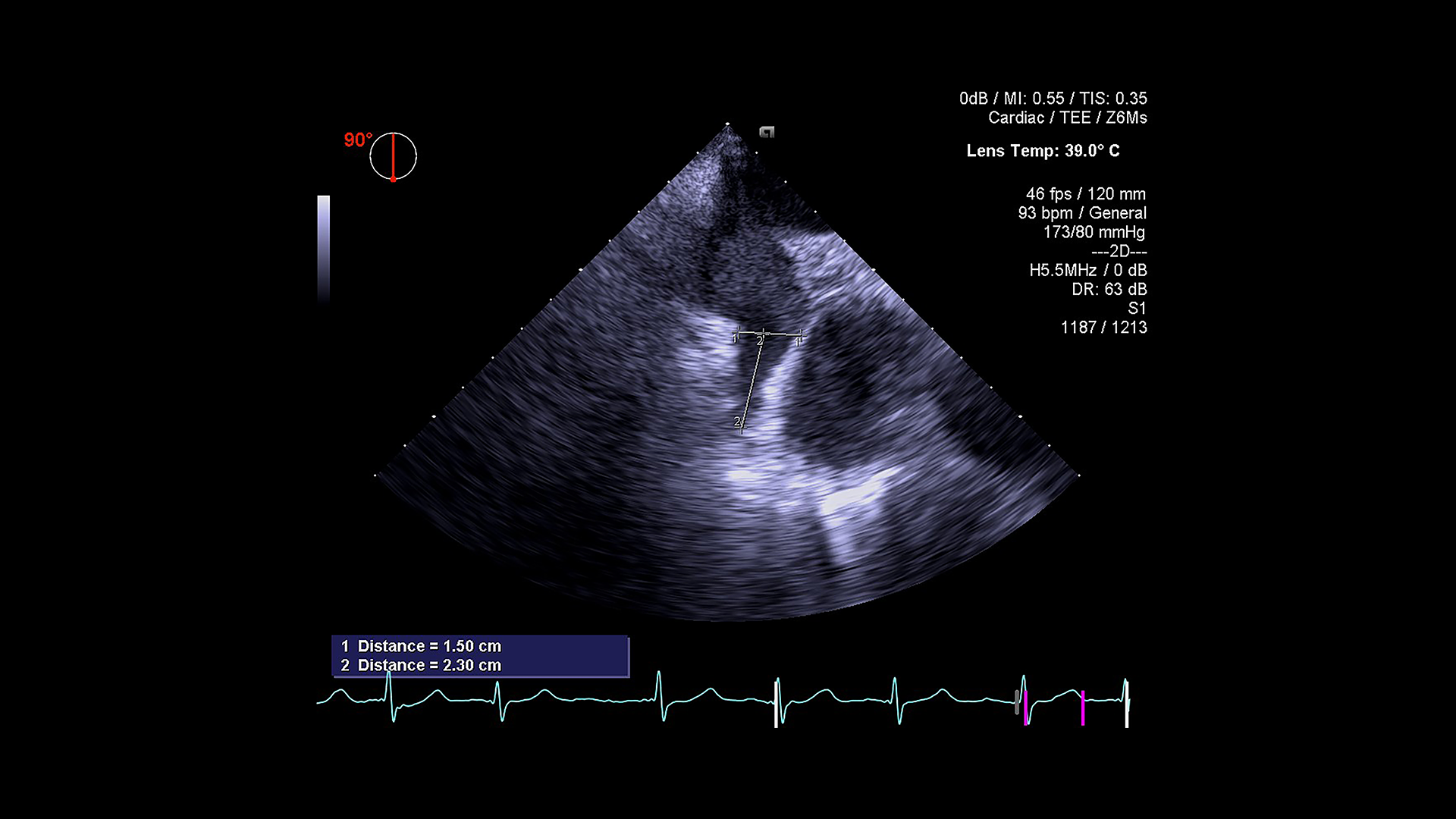 Cardiovascular Ultrasound | ACUSON SC2000 Ultrasound System - Siemens ...