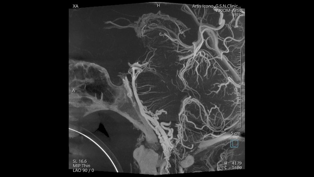 syngo DynaCT - Siemens Healthineers