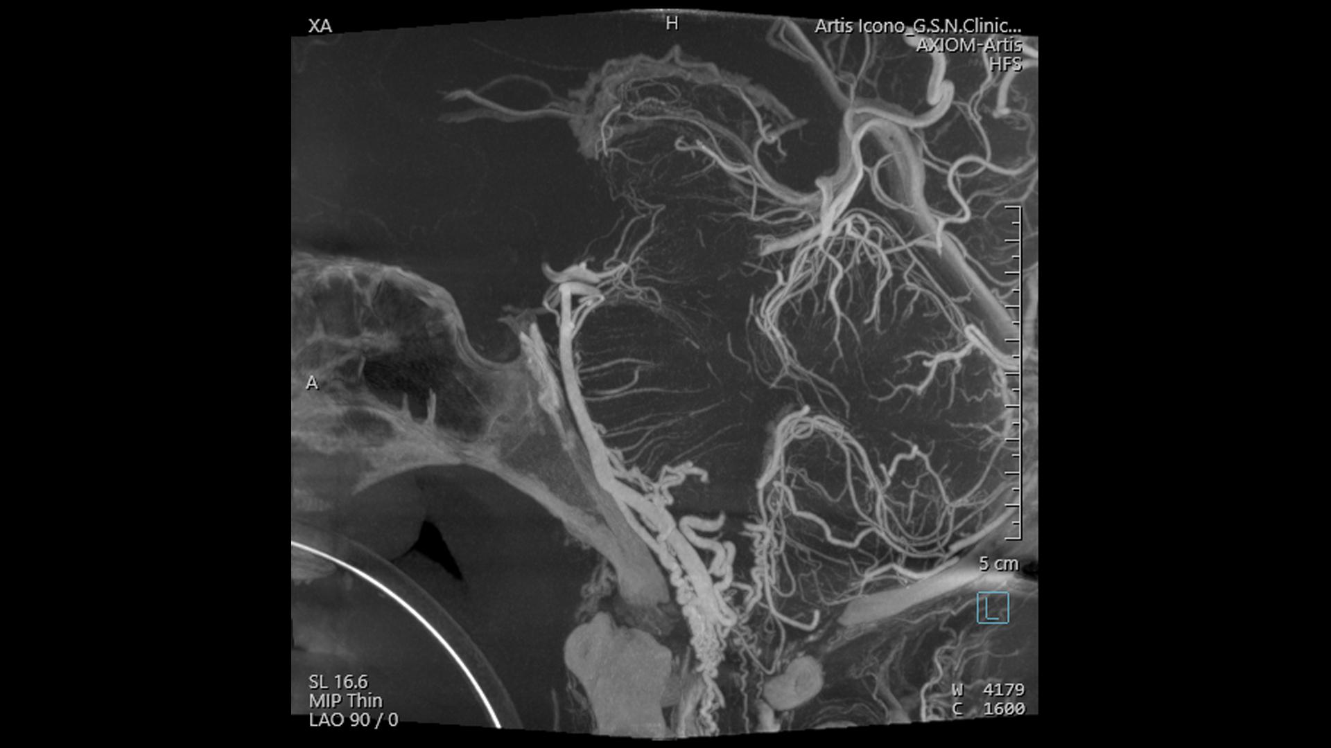 syngo DynaCT - Siemens Healthineers