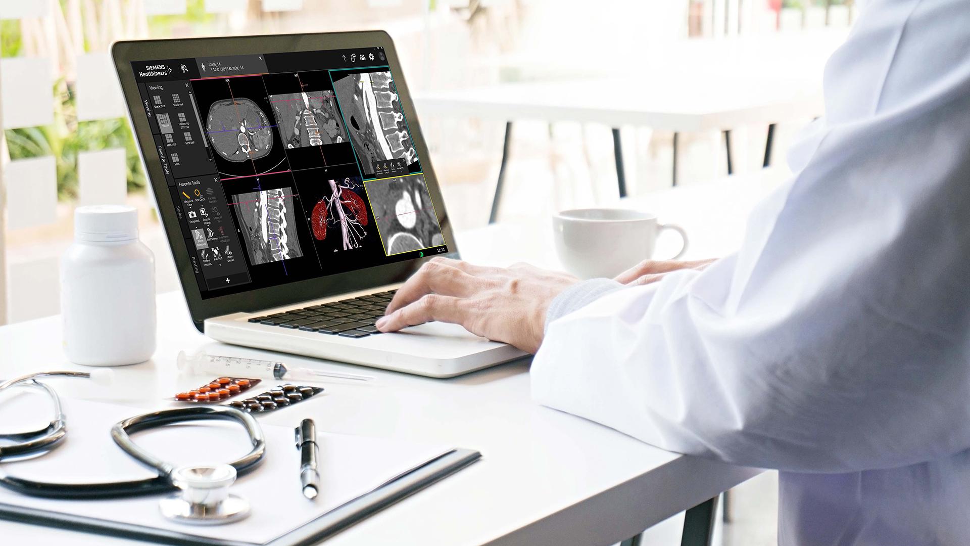 SOMATOM go.All - Siemens Healthineers Brasil