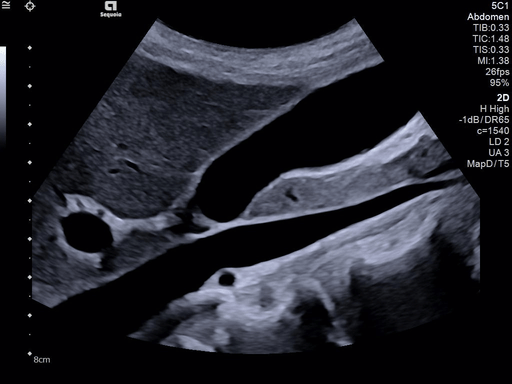 ACUSON Sequoia Ultrasound System - Siemens Healthineers USA