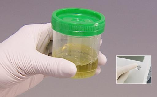 Proper Testing Technique for the CLINITEST hCG Pregnancy Test - Siemens ...