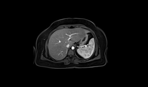 MAGNETOM Avanto Fit - Siemens Healthineers