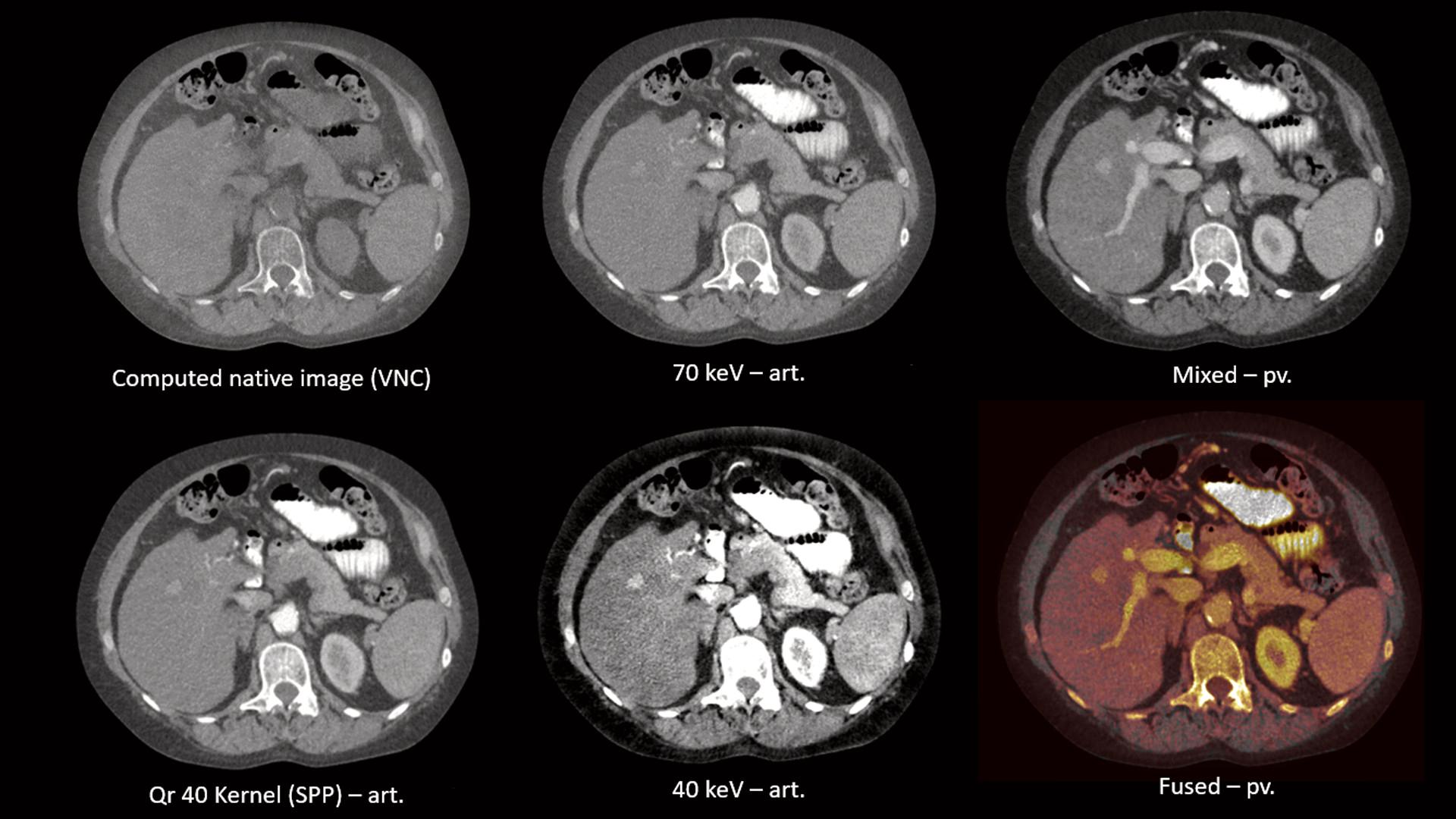 The Siemens Healthineers CT Imaging Chain - Siemens Healthineers