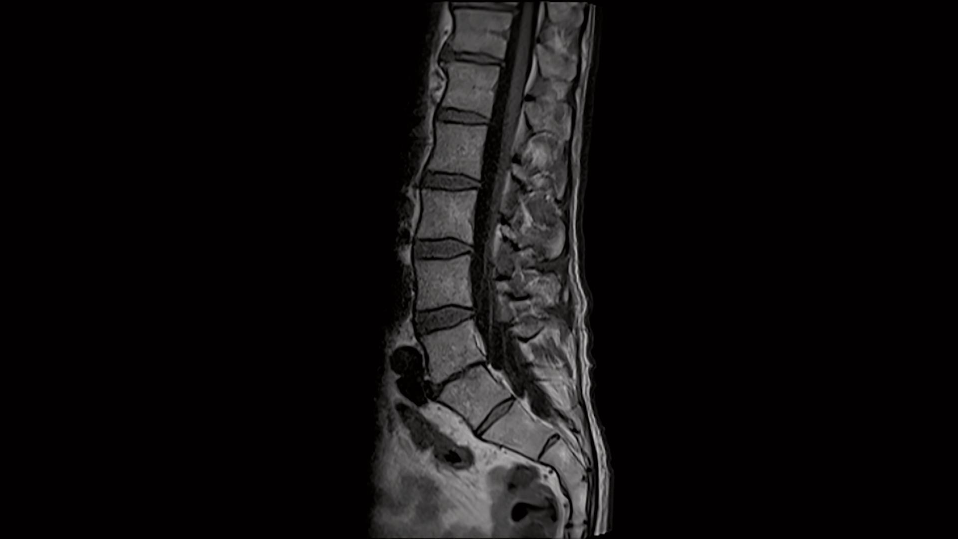 MAGNETOM Free.Max – Open Bore MRI - Siemens Healthineers USA