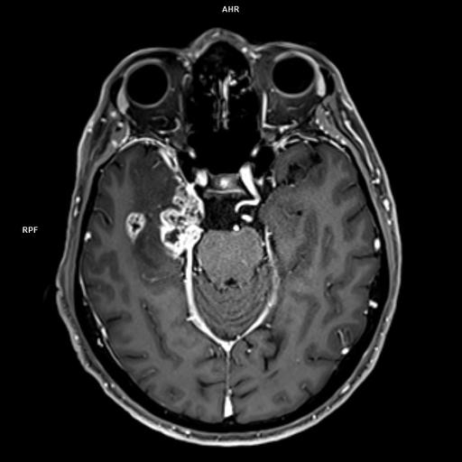 Axial 3D T1 MPRAGE-MAGNETOM Vida - Siemens Healthineers USA