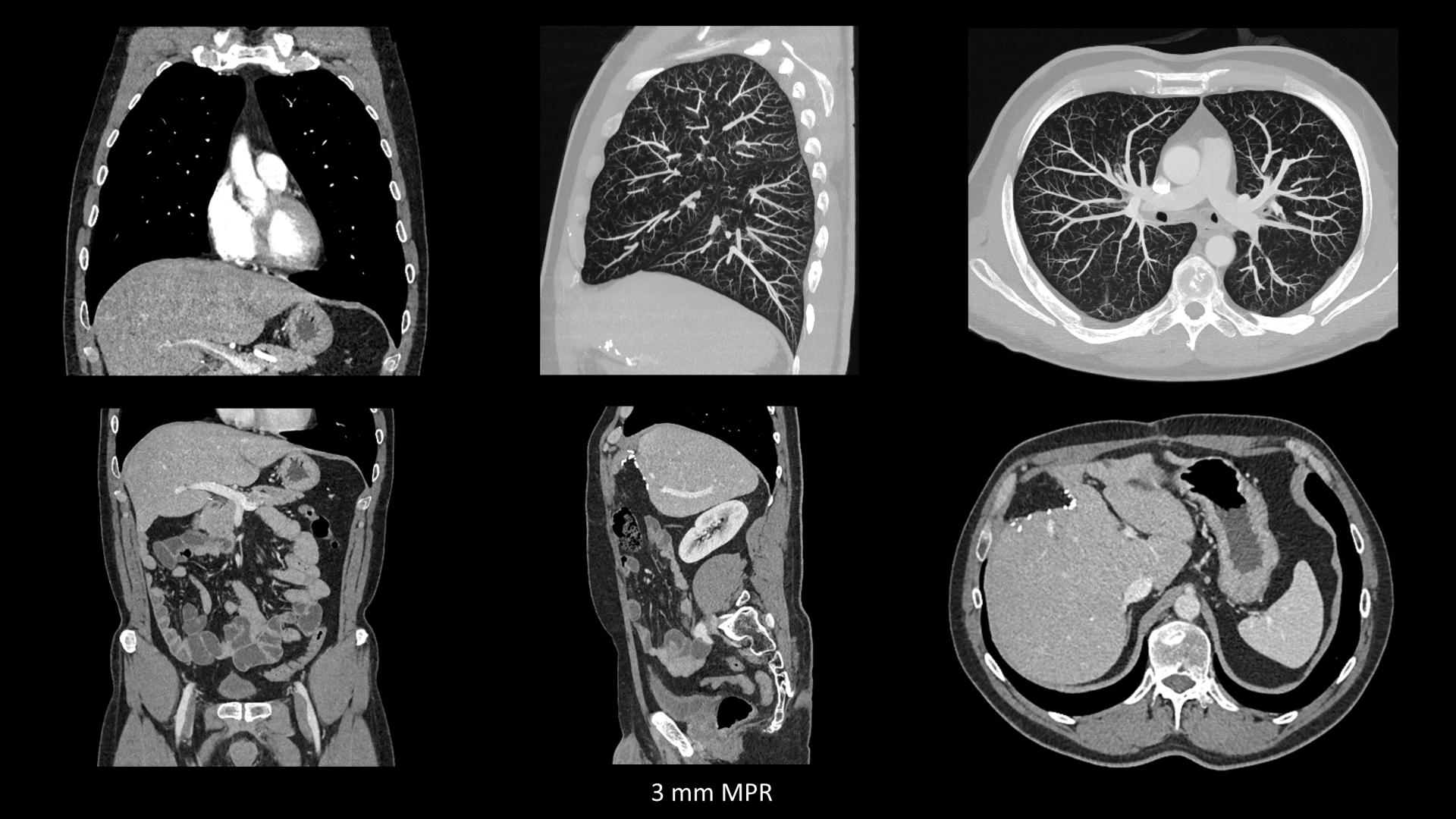 SOMATOM go.Up – Made to match - Siemens Healthineers USA