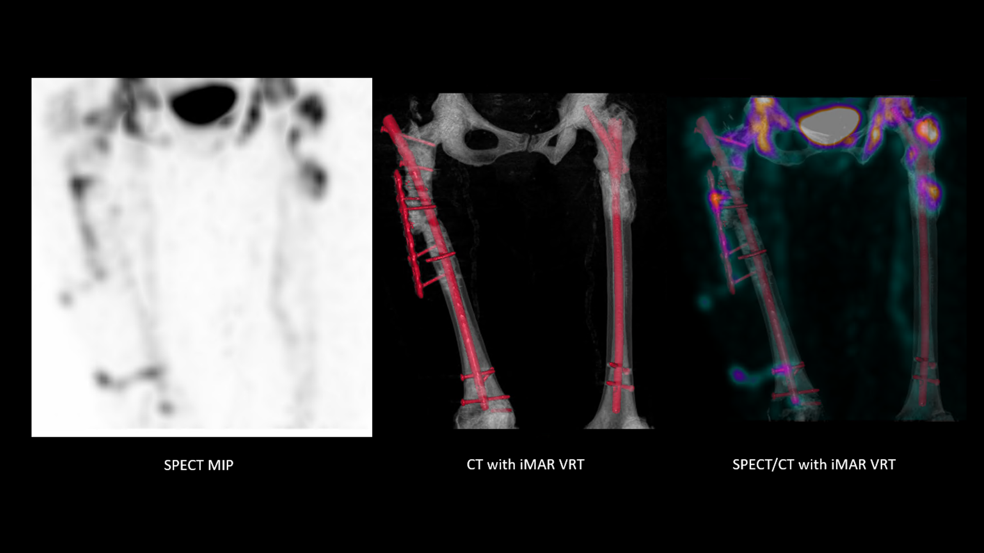 Symbia Pro.specta SPECT/CT - Siemens Healthineers Canada