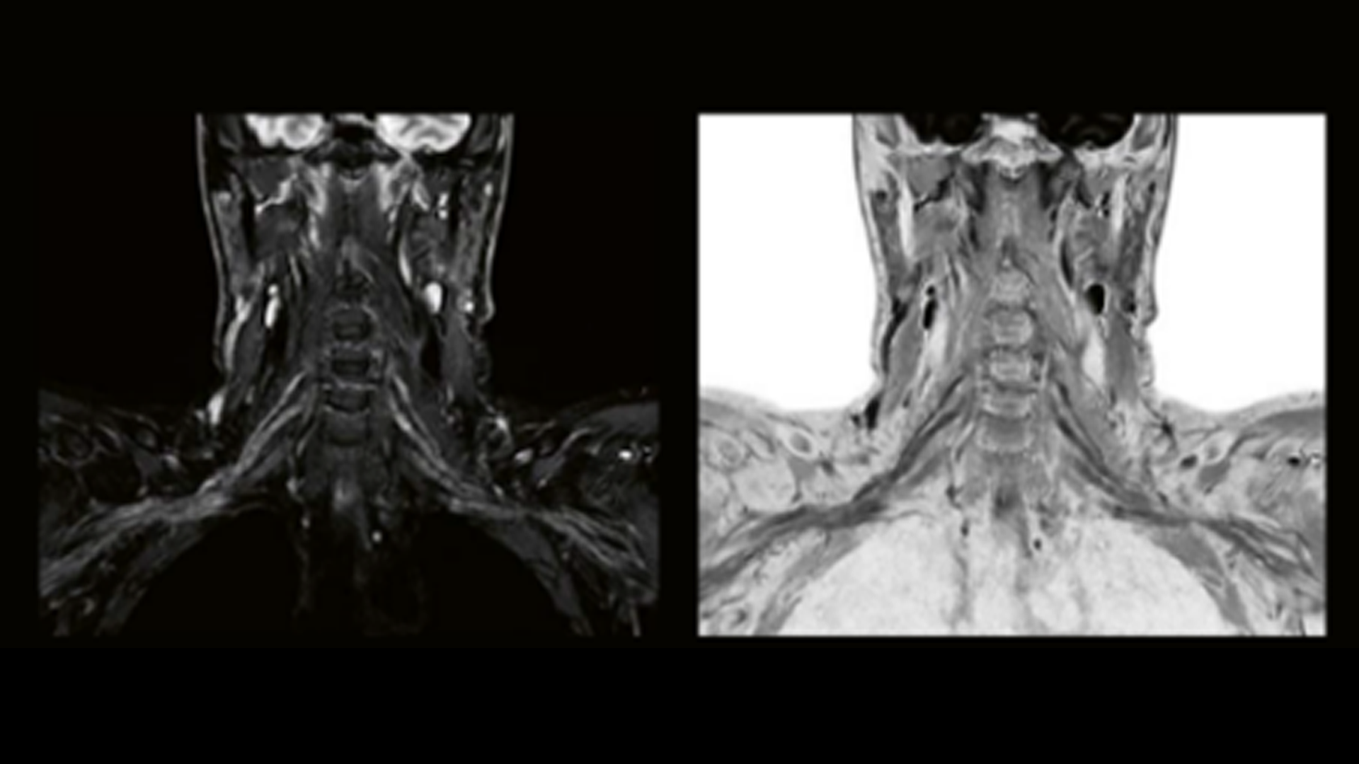 BioMatrix Technology - Siemens Healthineers