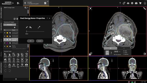 syngo.via RT Image Suite - Siemens Healthineers