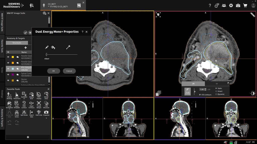 syngo.via RT Image Suite - Siemens Healthineers