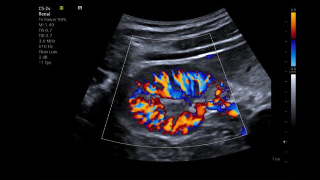 ACUSON Maple is a High-Performance Shared Service Ultrasound System ...