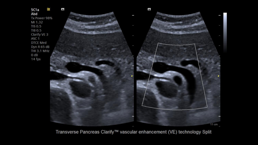 ACUSON Maple is a High-Performance Shared Service Ultrasound System ...