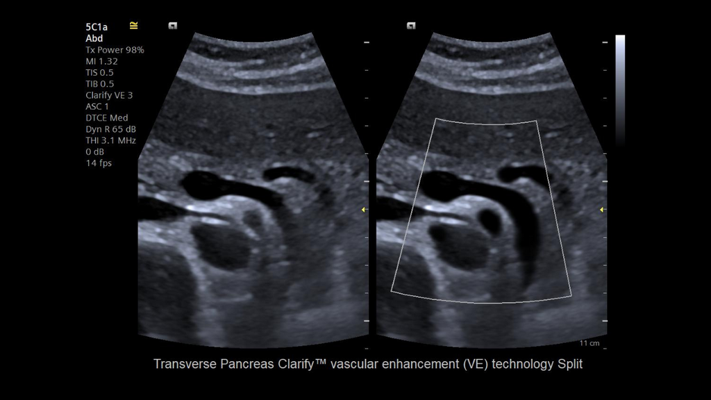 ACUSON Maple is a High-Performance Shared Service Ultrasound System ...