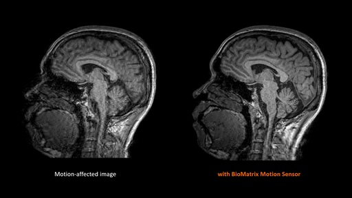 Neurology MRI - Siemens Healthineers