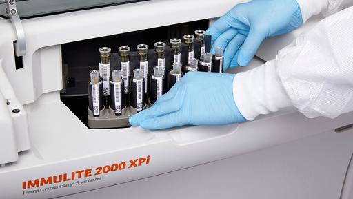 IMMULITE 2000 XPi System Inflammation Panel - Siemens Healthineers
