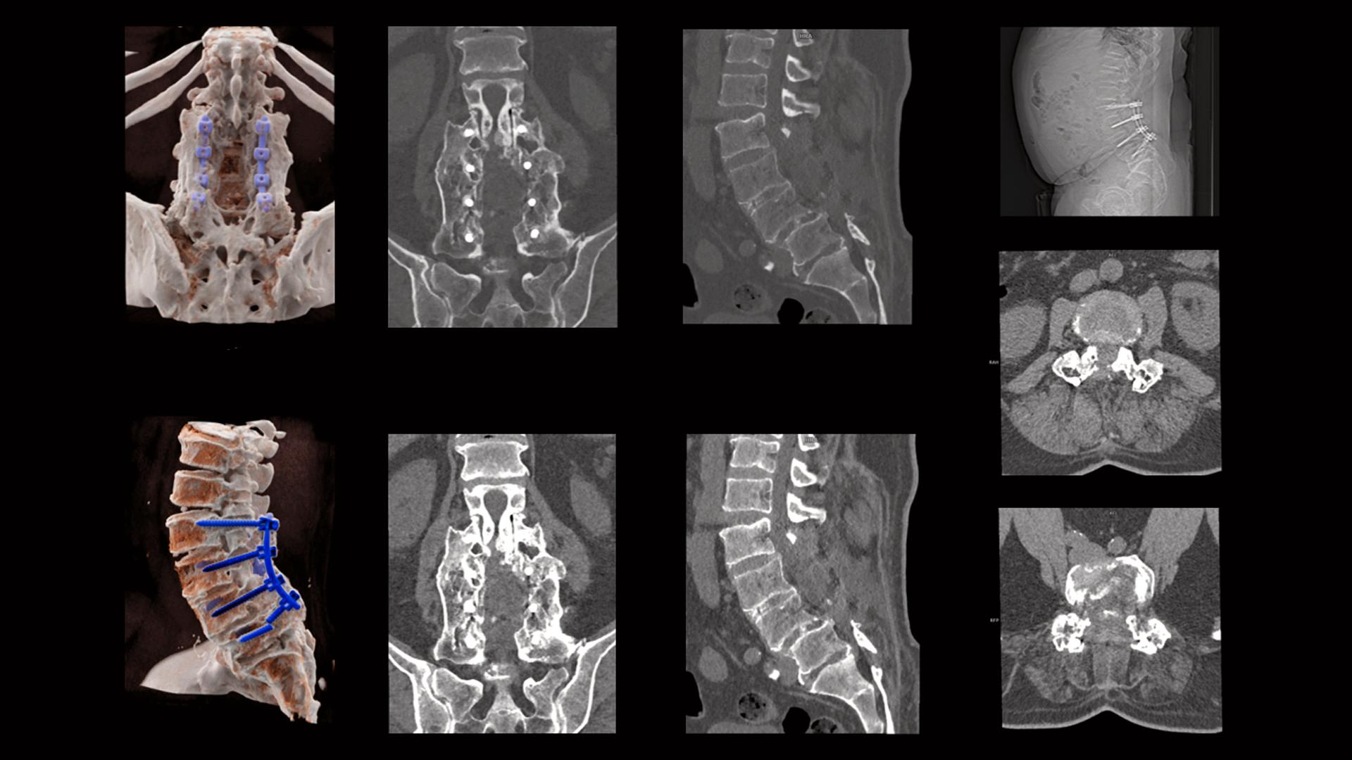 The Siemens Healthineers CT Imaging Chain - Siemens Healthineers