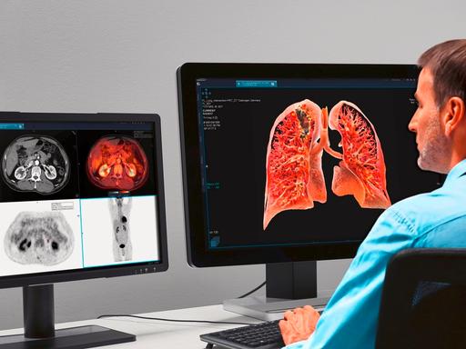 Computed Tomography - Siemens Healthineers India