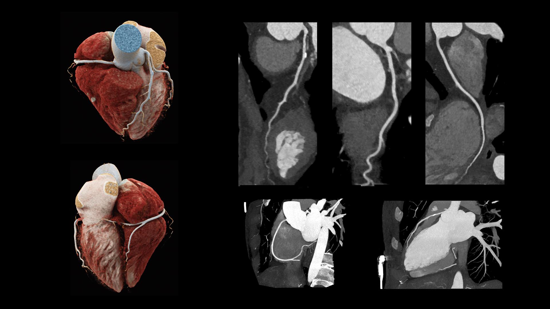 The SOMATOM X. platform – Intelligent imaging - Siemens Healthineers USA