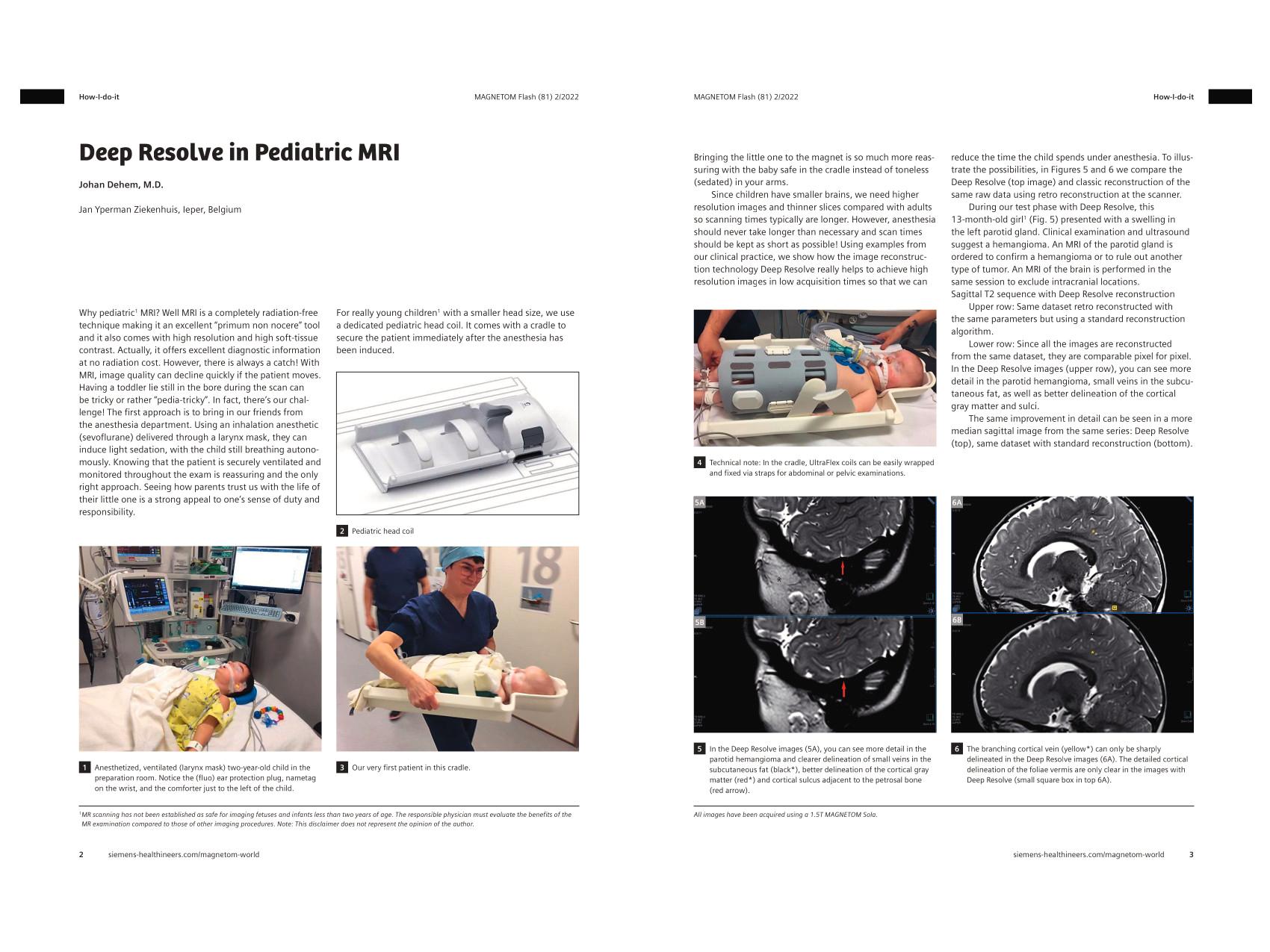 Sedation-Free Pediatric Neuroimaging with Deep Resolve 3D MR Sequences