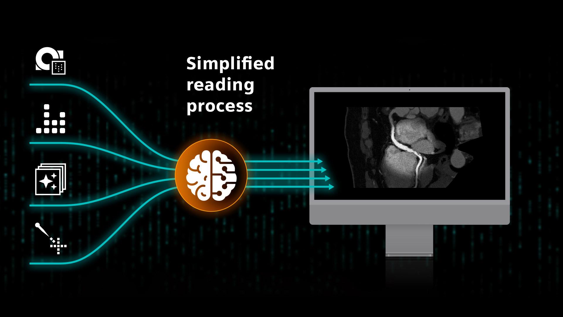 AI-powered Productivity in Photon-counting CT | NAEOTOM Alpha class ...