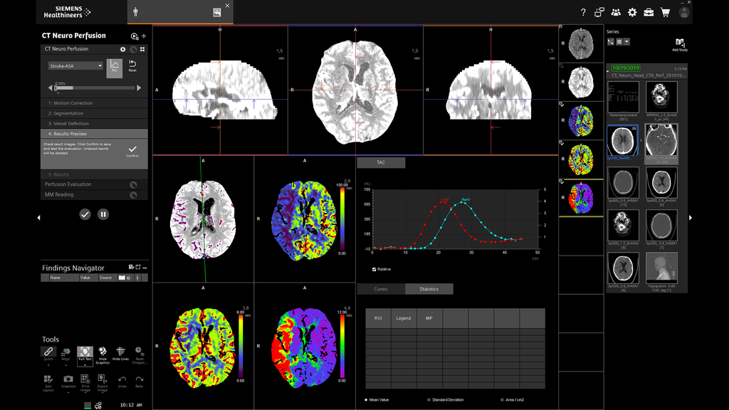 syngo.via - Siemens Healthineers Brasil