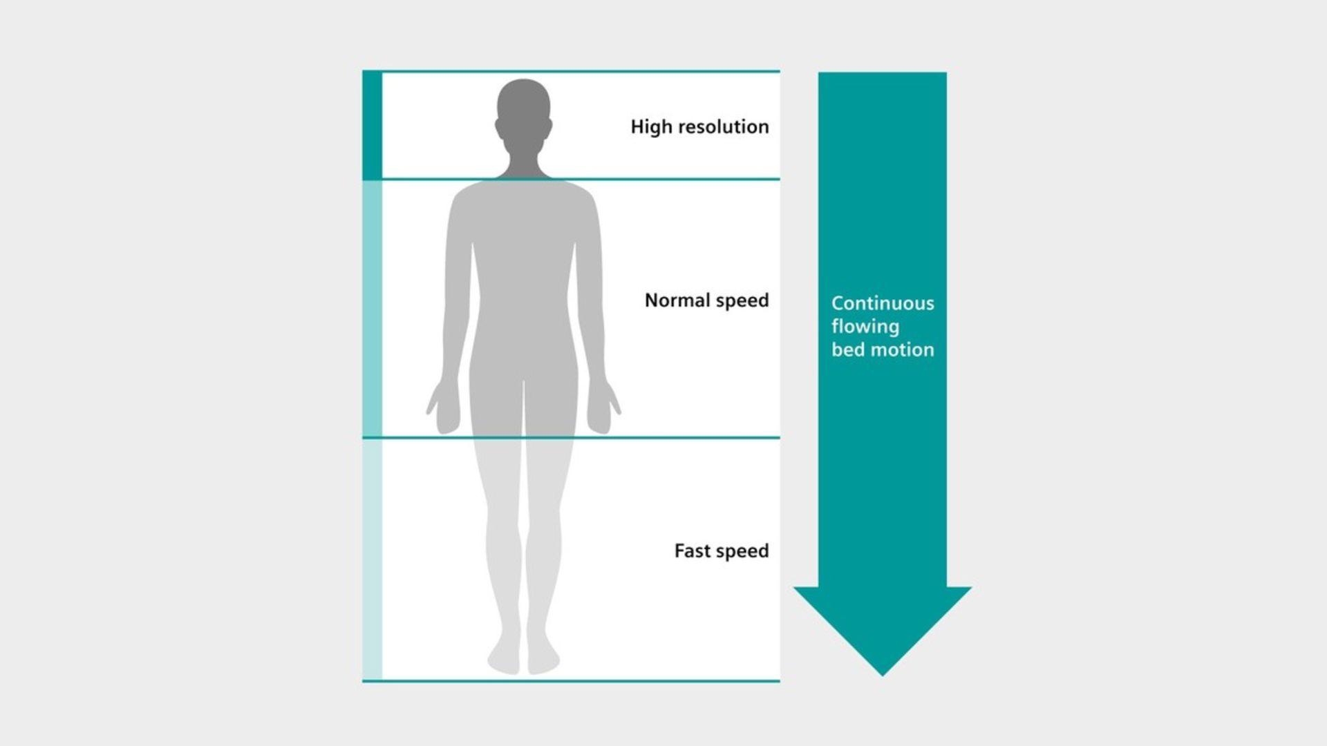 FlowMotion AI: An AIDAN Technology - Siemens Healthineers USA