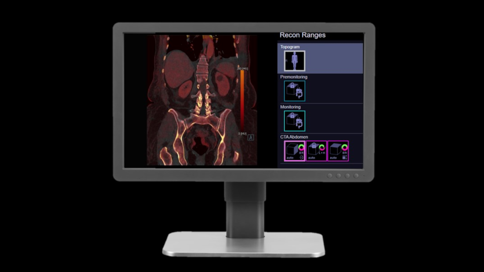 Dual Energy CT Spectral Imaging - Siemens Healthineers USA
