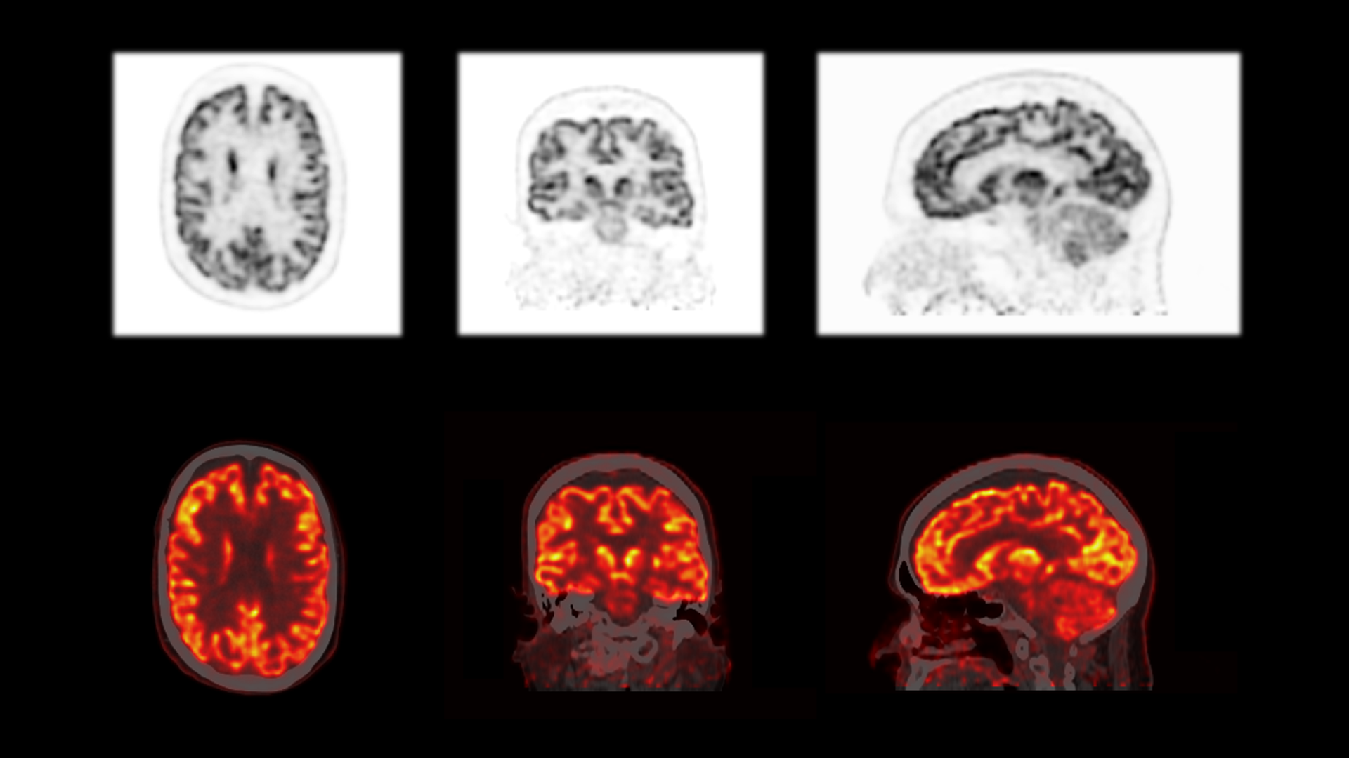 Digital Pet Ct Siemens at Stanley Musso blog