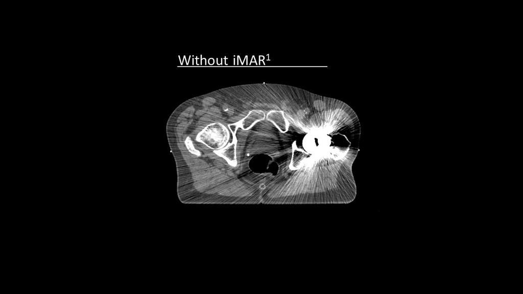 SOMATOM go.Open Pro - Siemens Healthineers