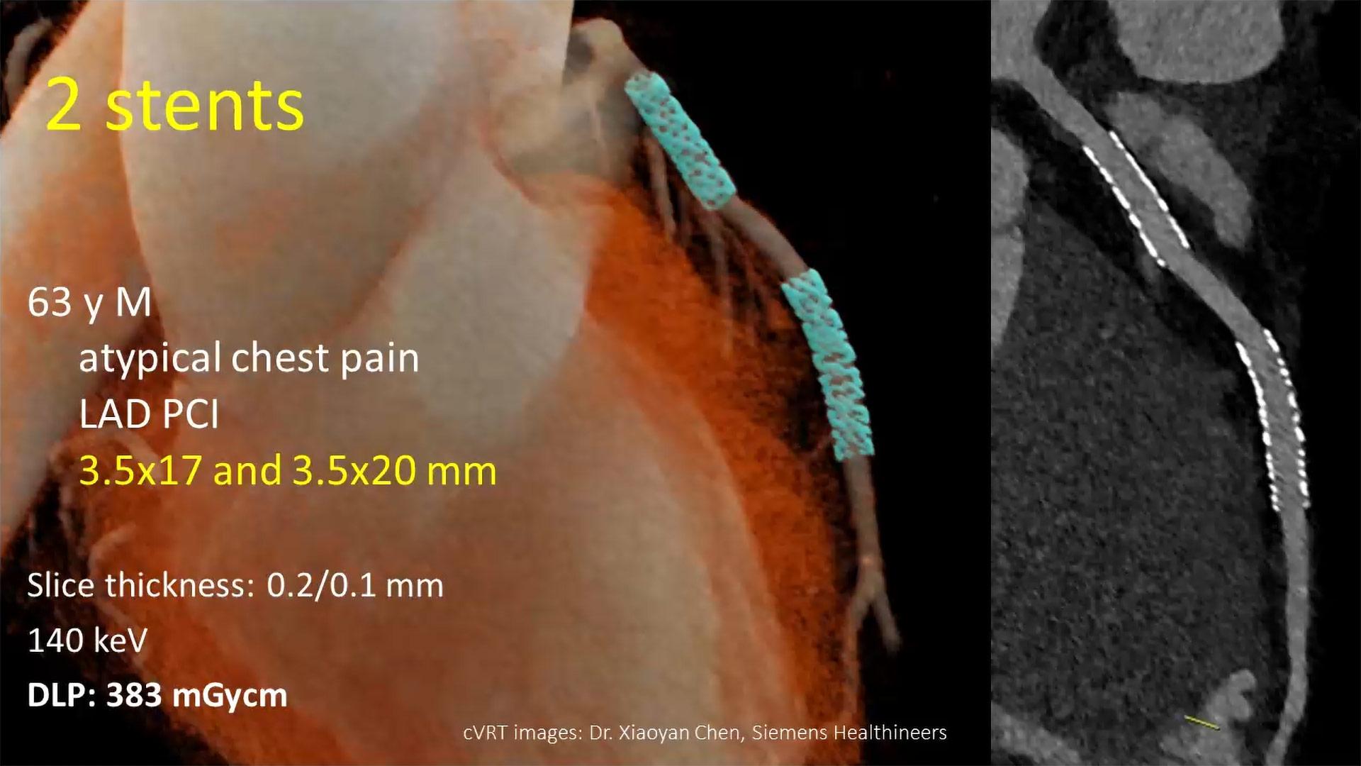 Game changer in cardiac iamging?