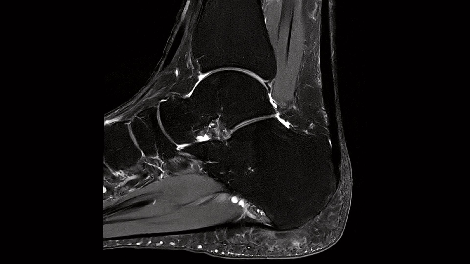 MAGNETOM Cima.X - Make the difference. - Siemens Healthineers