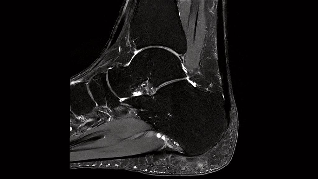 MAGNETOM Cima.X - Make the difference. - Siemens Healthineers