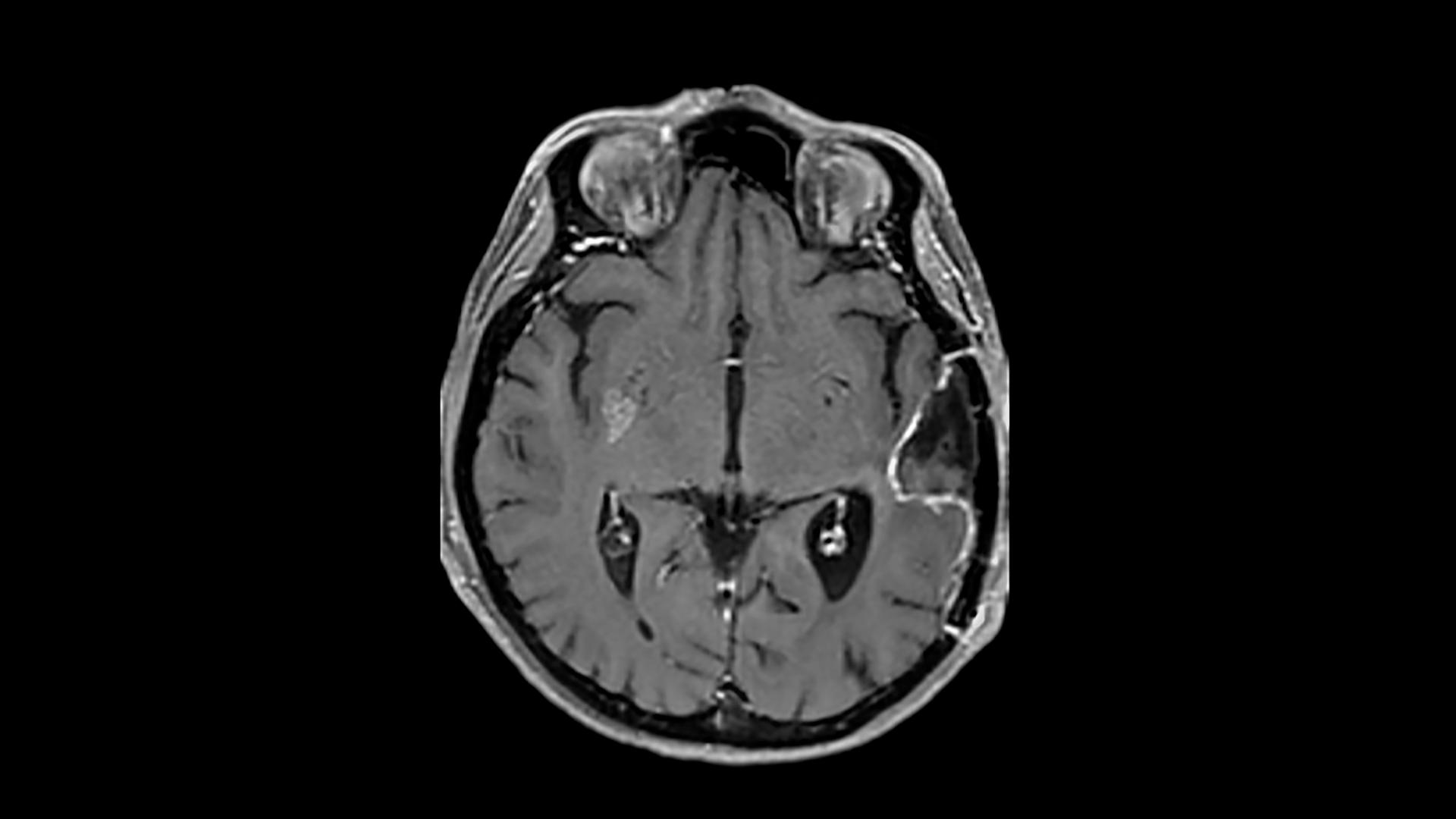 Phoenix Images for MAGNETOM Sola 1.5T