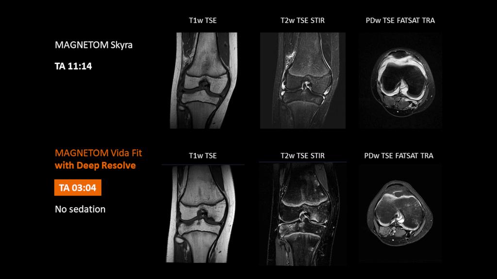 Pediatric MRI - Siemens Healthineers