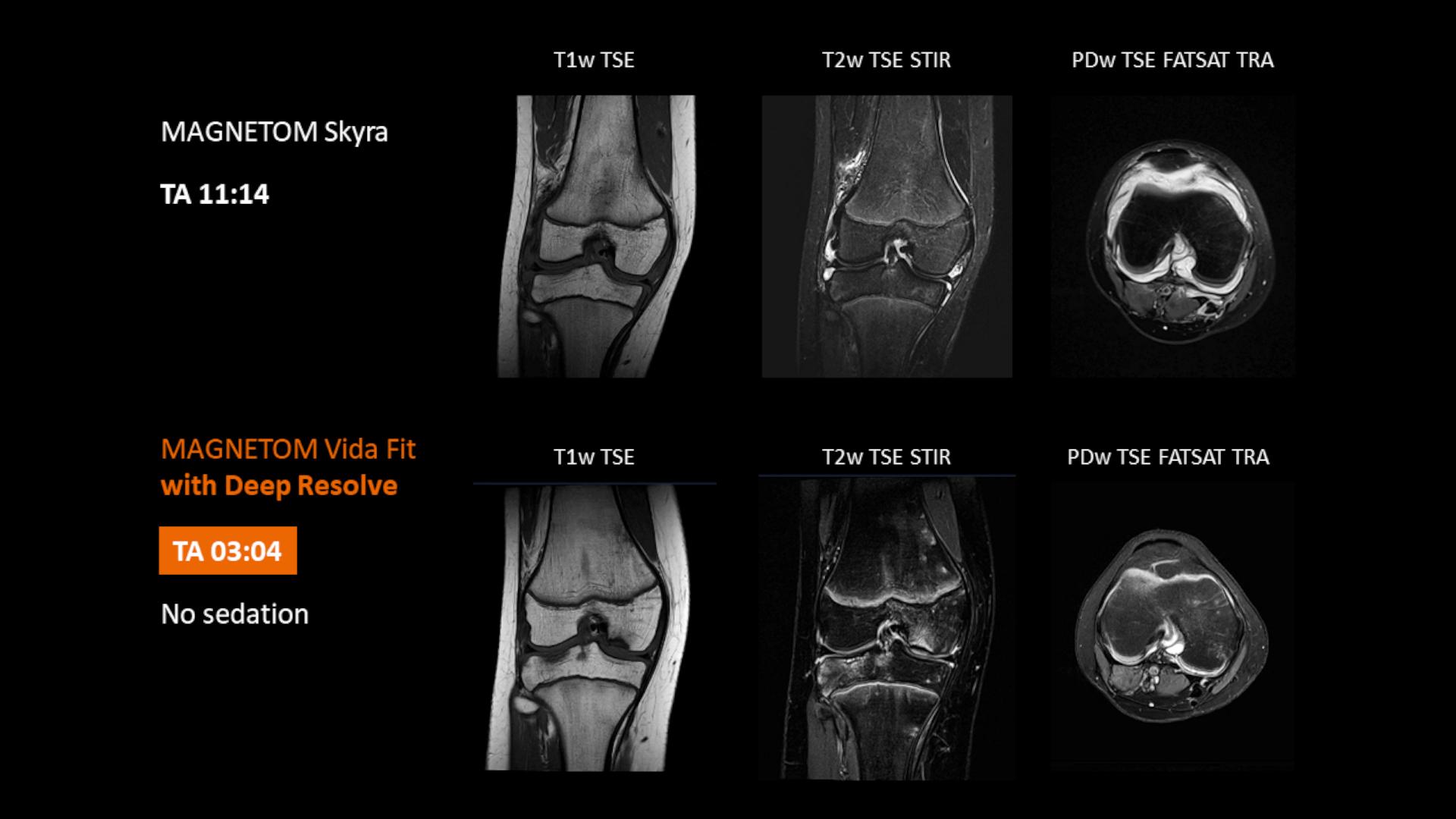 Pediatric MRI - Siemens Healthineers