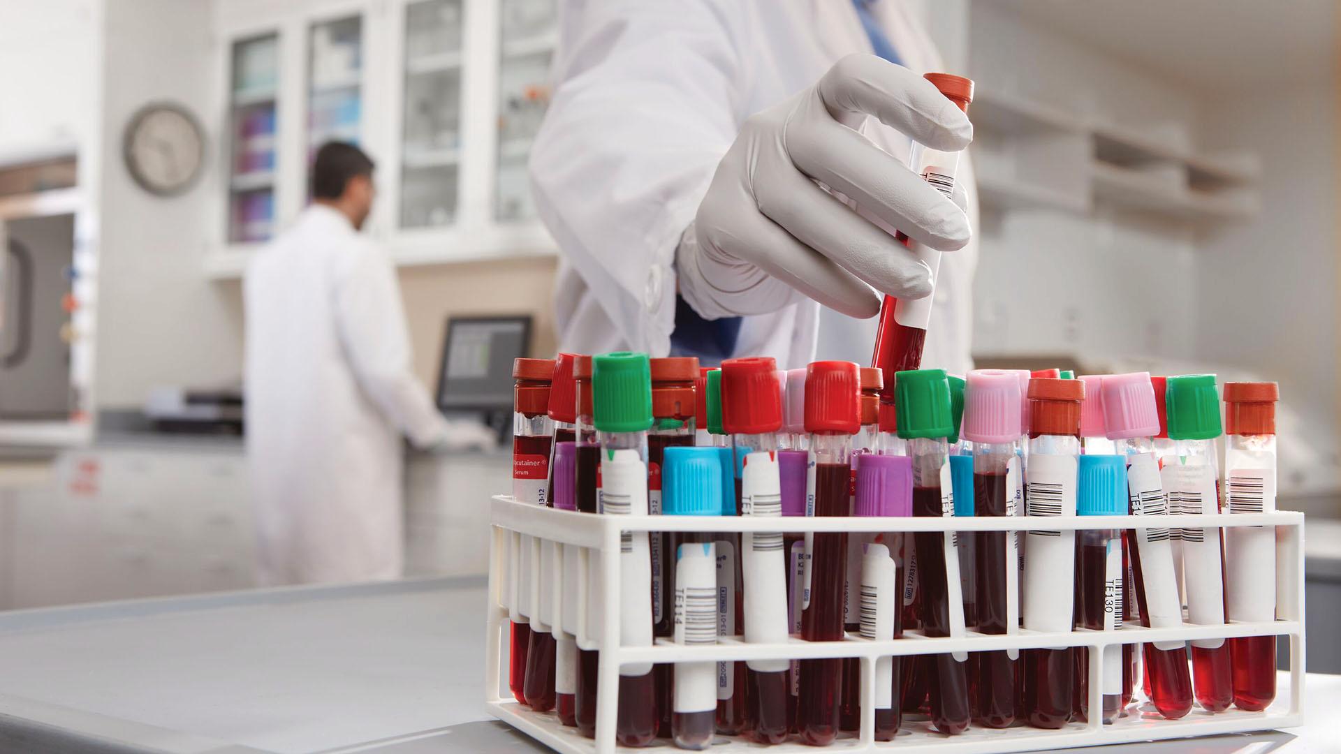 Considerations for Infectious Disease Testing in YOUR Laboratory ...