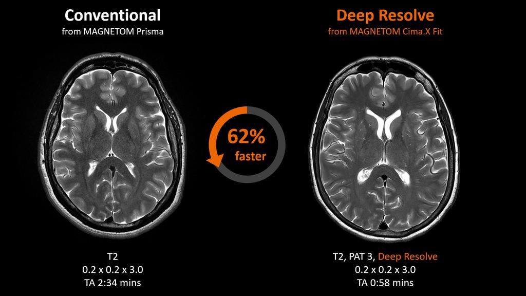 MAGNETOM Cima.X Fit - Siemens Healthineers