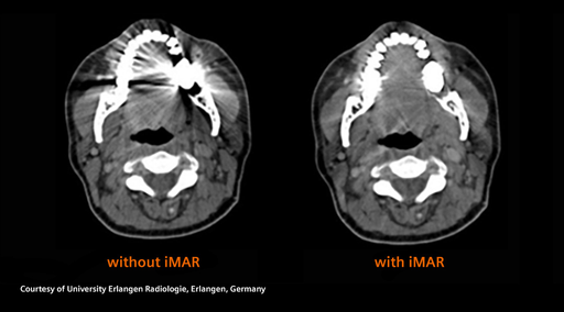 iMAR White Paper - Siemens Healthineers USA