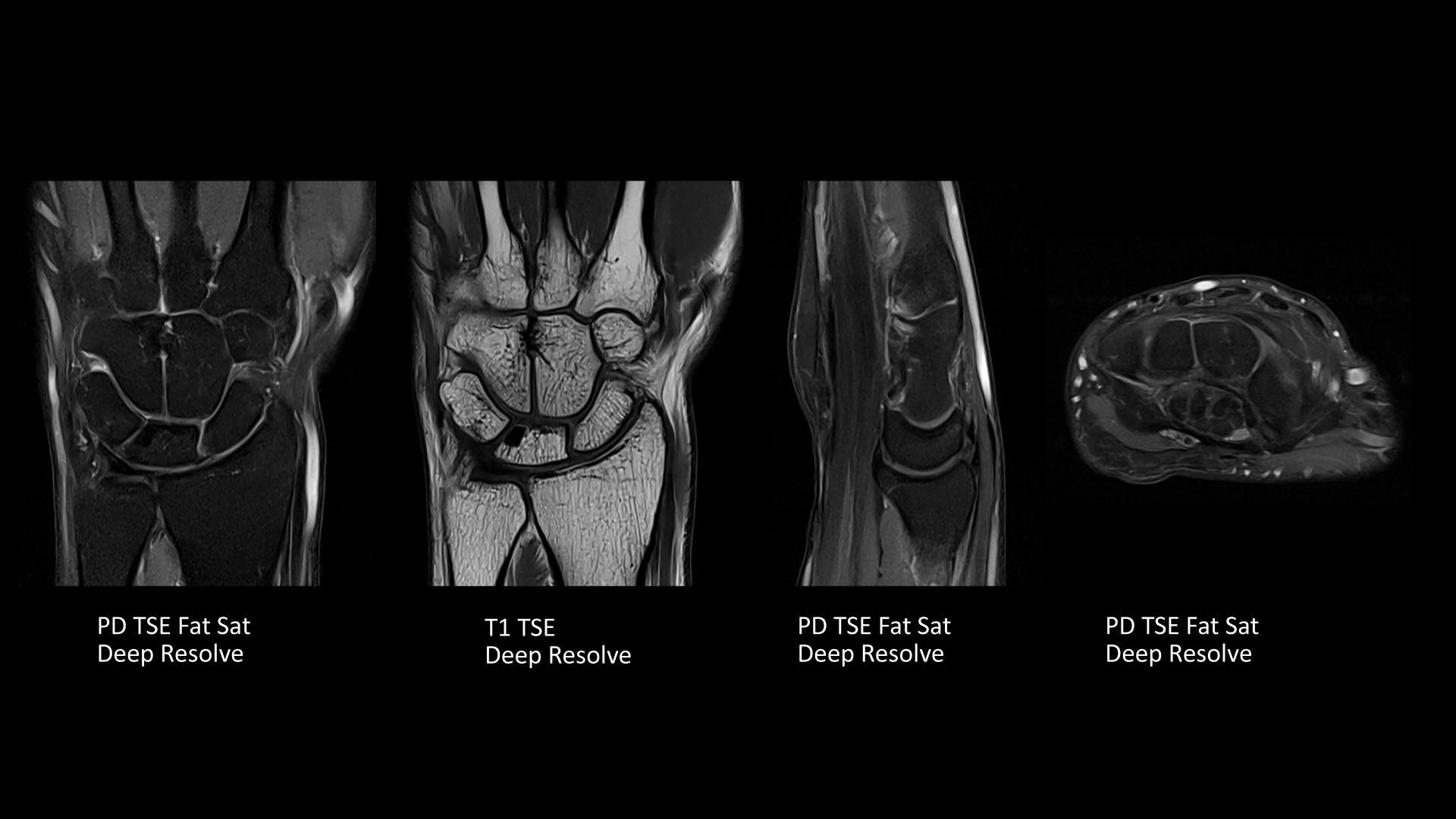 BioMatrix Contour Coils - Siemens Healthineers