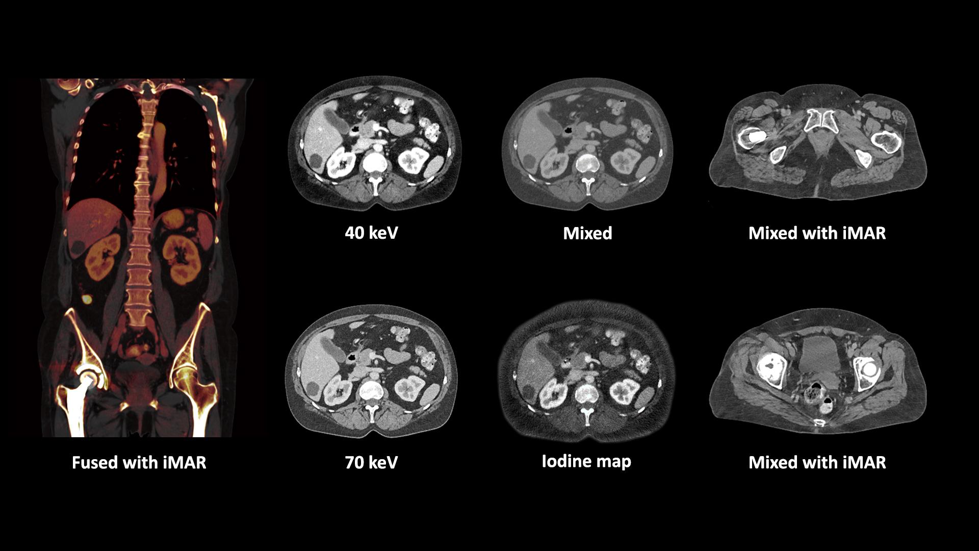 SOMATOM X.cite mit myExam Companion – Siemens Healthineers Deutschland