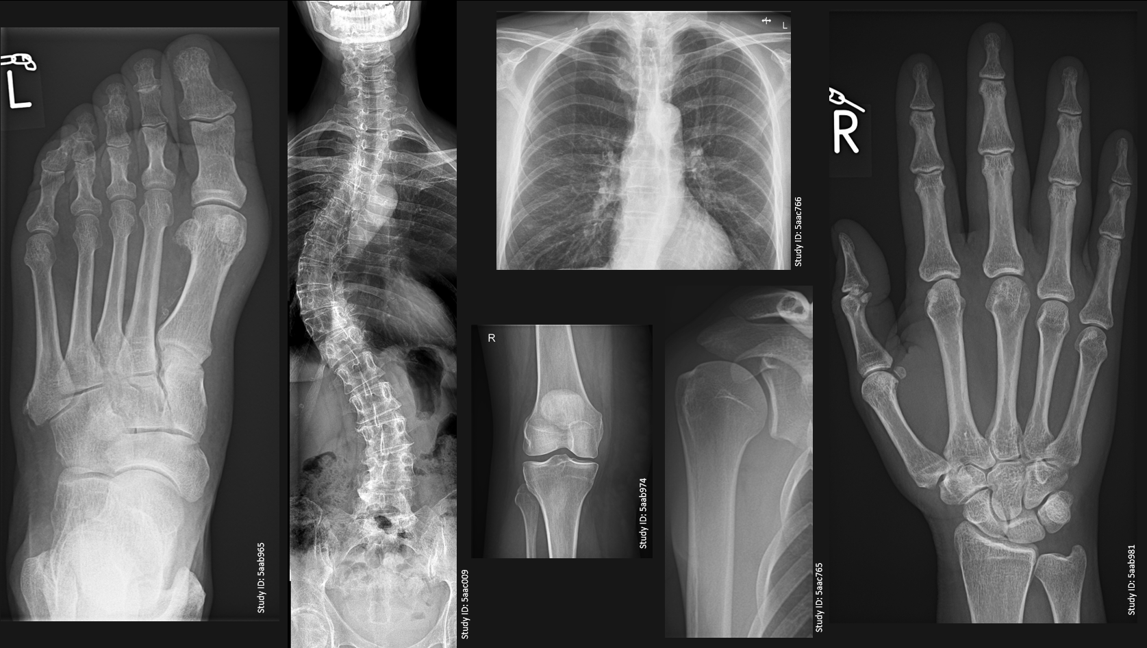 MULTIX Impact with myExam Companion - Siemens Healthineers