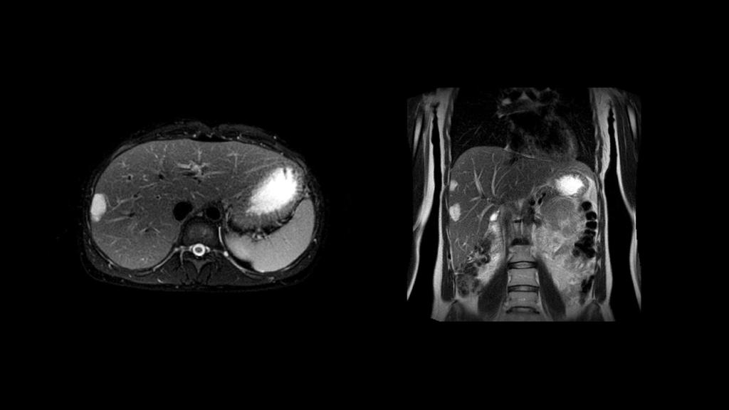 BioMatrix Contour Coils - Siemens Healthineers