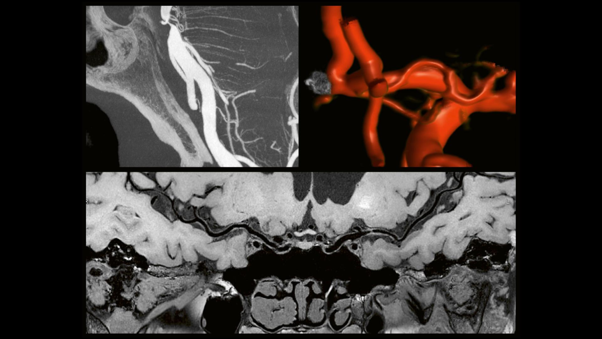 MRI Case Studies, MRI Case Study, MRI Case