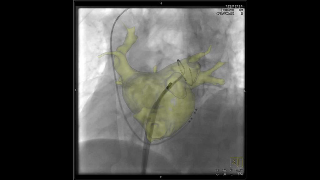 Cardiology Solutions - Siemens Healthineers