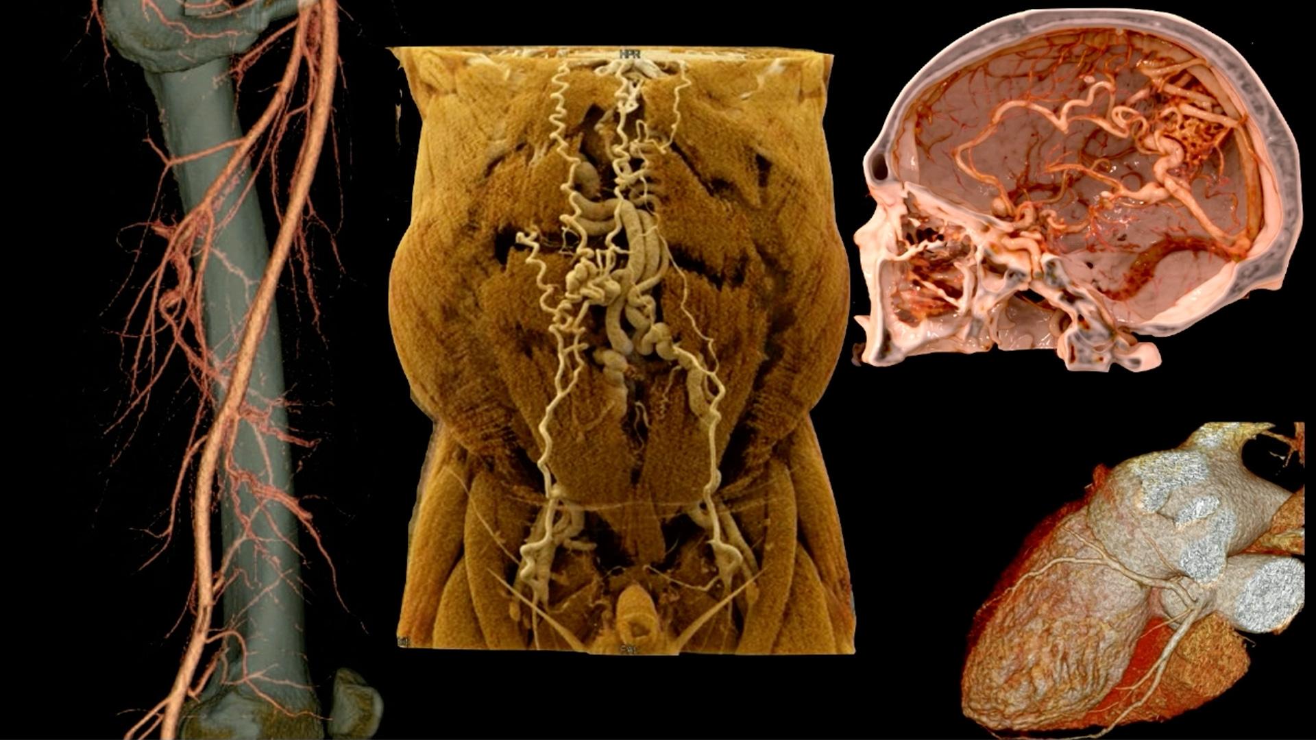 Advancing CT practice for greatest clinical impact - Siemens Healthineers