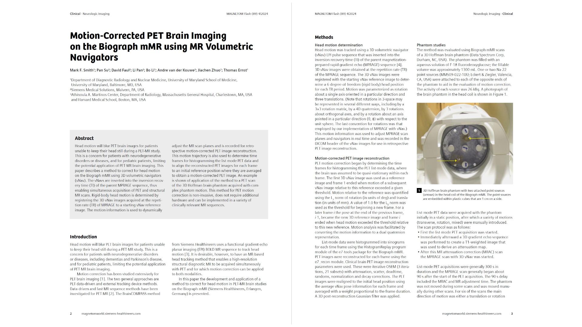 MRI Case Studies, MRI Case Study, MRI Case