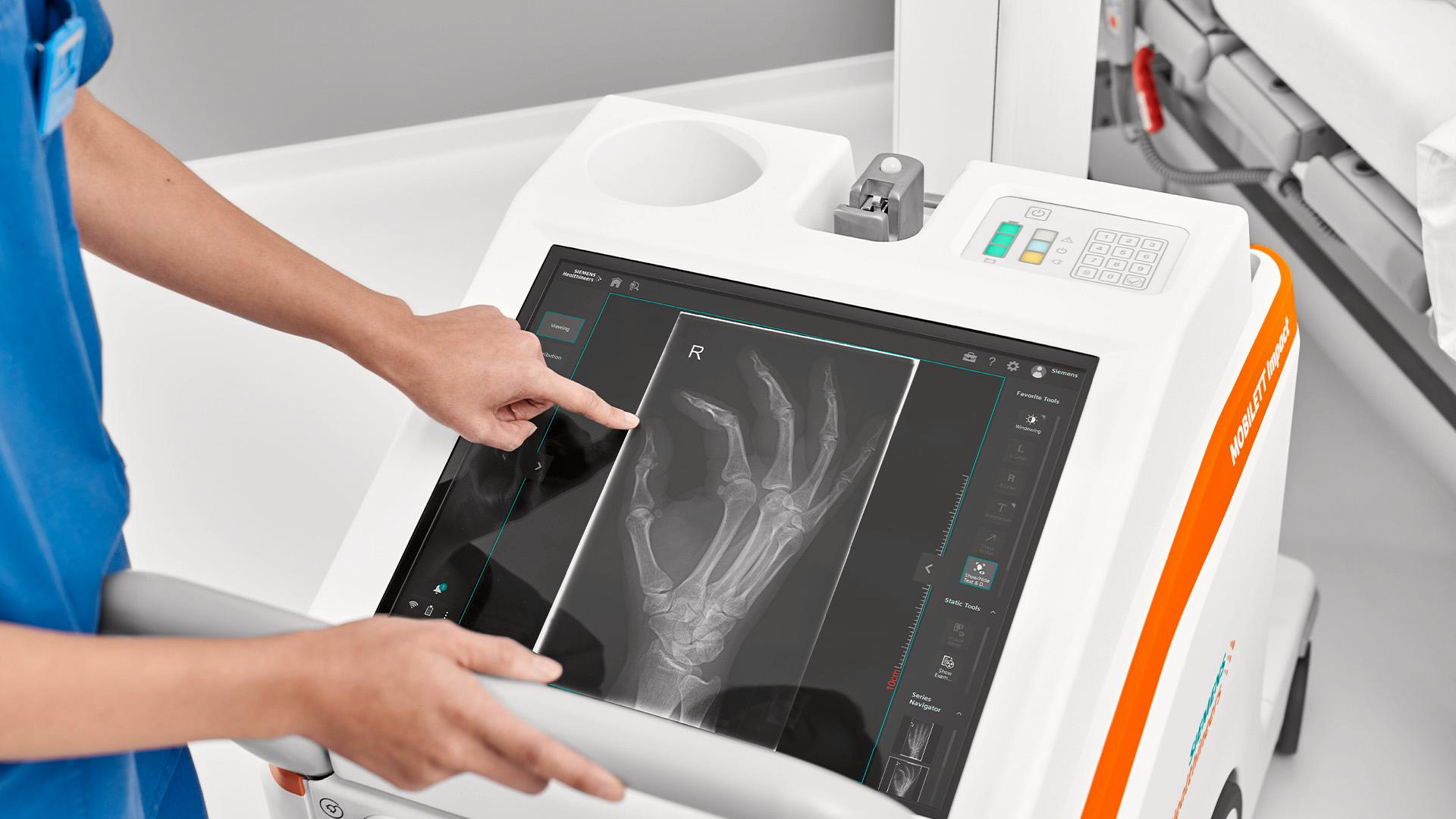 MOBILETT Impact - Siemens Healthineers