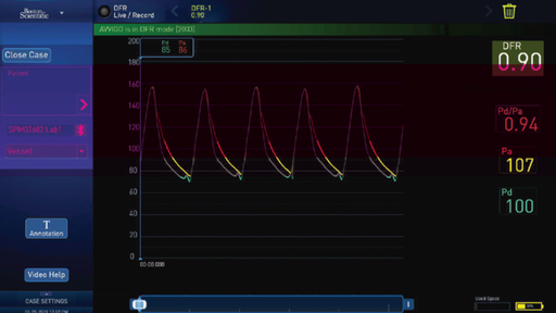 AVVIGO™+ Guidance System - Siemens Healthineers USA