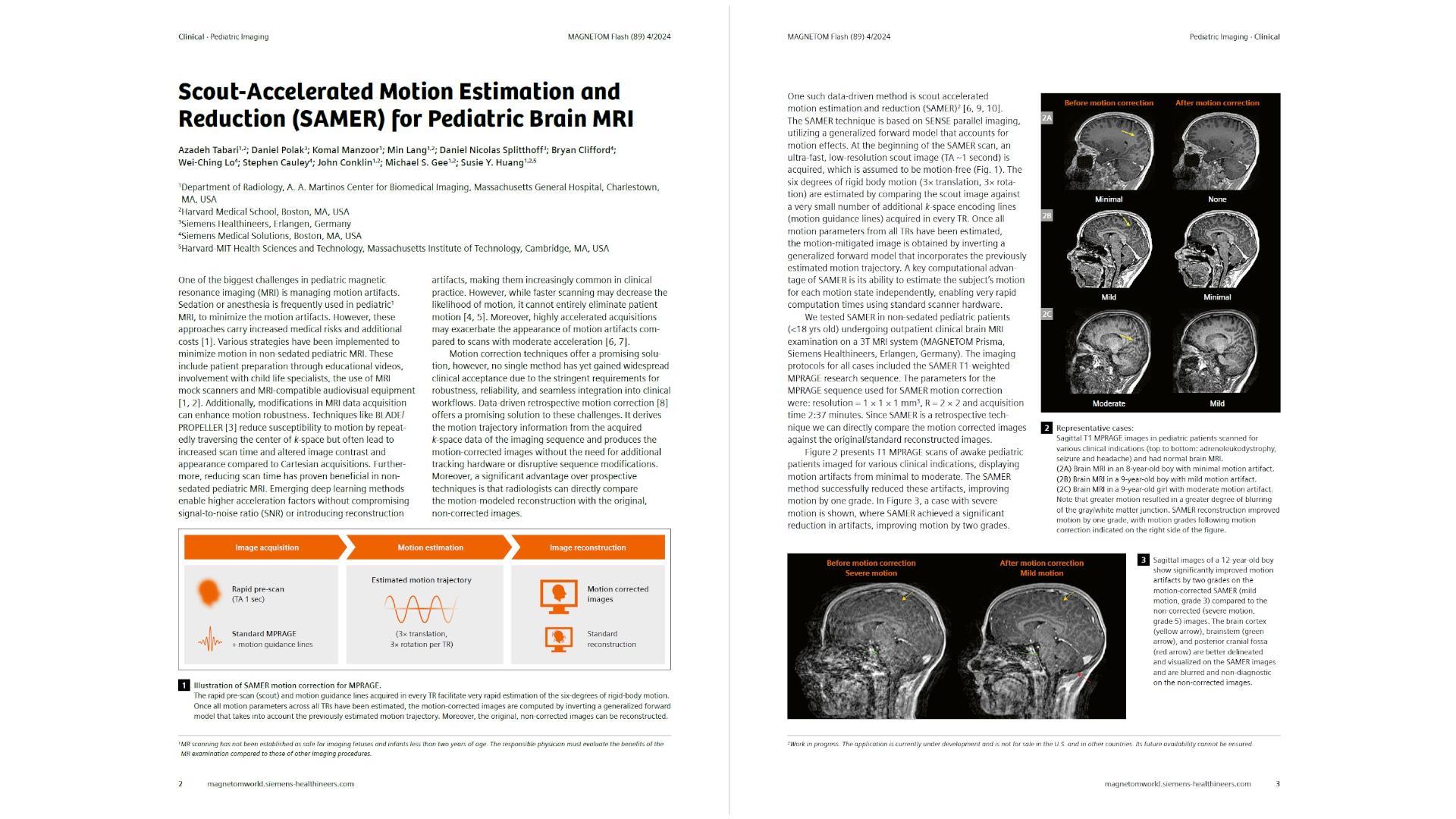 MRI Case Studies, MRI Case Study, MRI Case